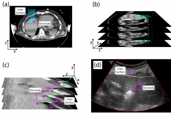 Ultrasound Elastography Lab – Department of Medical Physics – UW–Madison